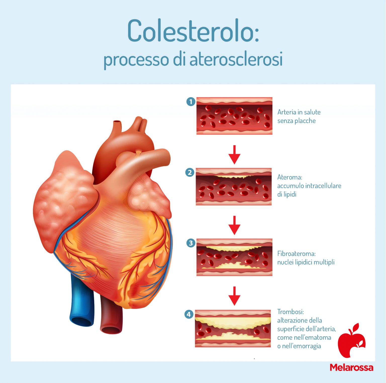 Colesterolo: cos'è e come combattere l'ipercolesterolemia - Melarossa