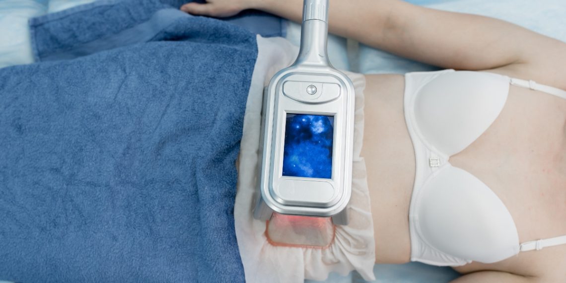 Criolipolisi: cos'è, come funziona, benefici e costi - Melarossa