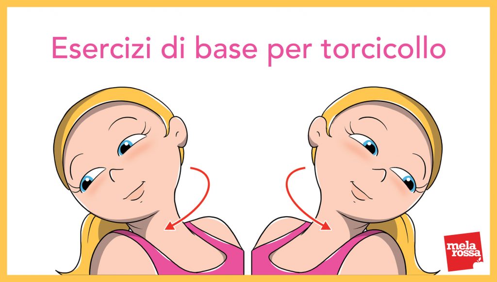 Torcicollo: cos’è, le cause che lo scatenano e come si cura- Melarossa