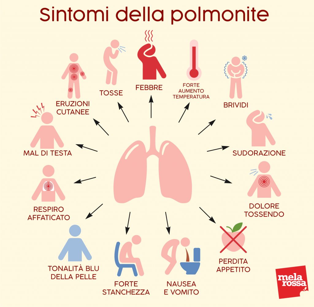 Polmonite: cos'è, epidemiologia, cause, tipi, sintomi, cura e prevenzione