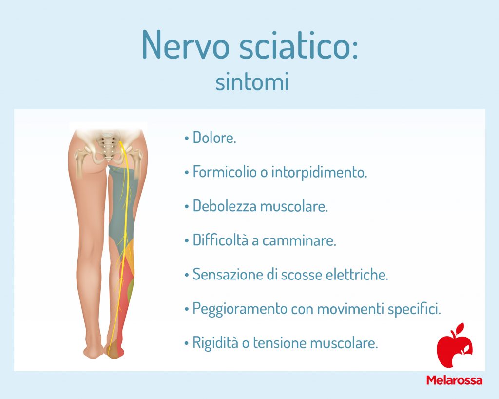 Nervo Sciatico Infiammato: Cause, Sintomi E Diagnosi – QKULE