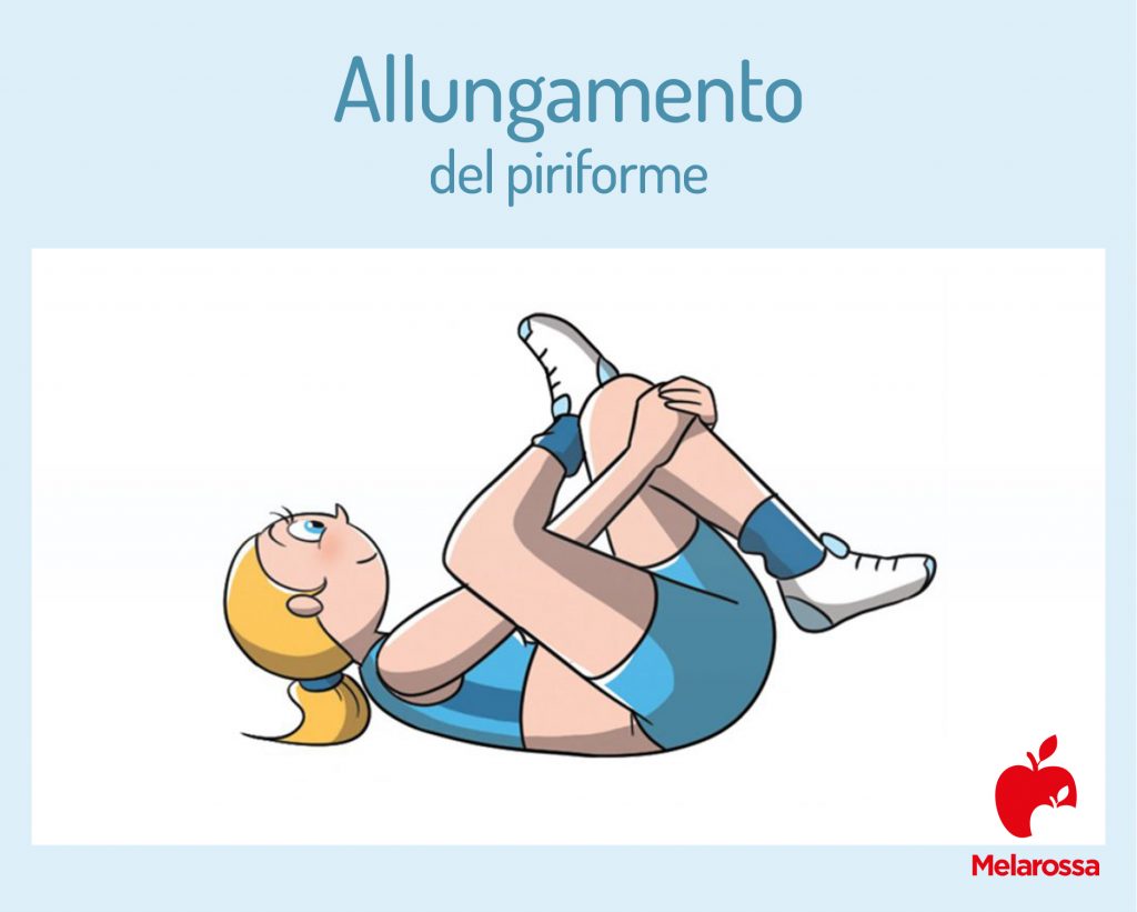 Sindrome del piriforme: cos'è, cause, sintomi e cura