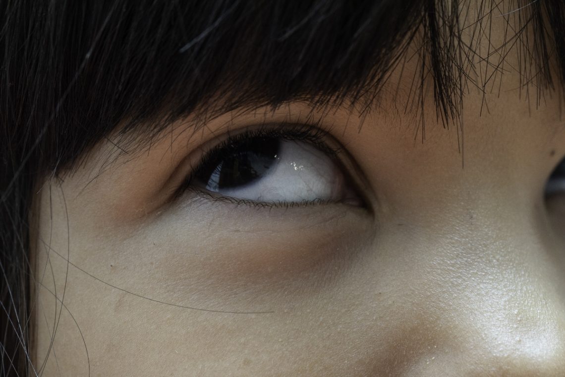 Epilessia: cos’è, sintomi, diagnosi, tipi e sindrome epilettiche