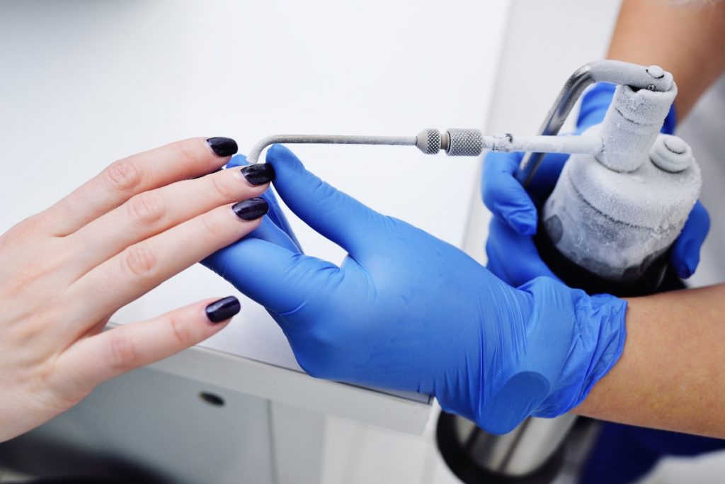 Verruche: cosa sono, sintomi, cause, cura e come prevenirle