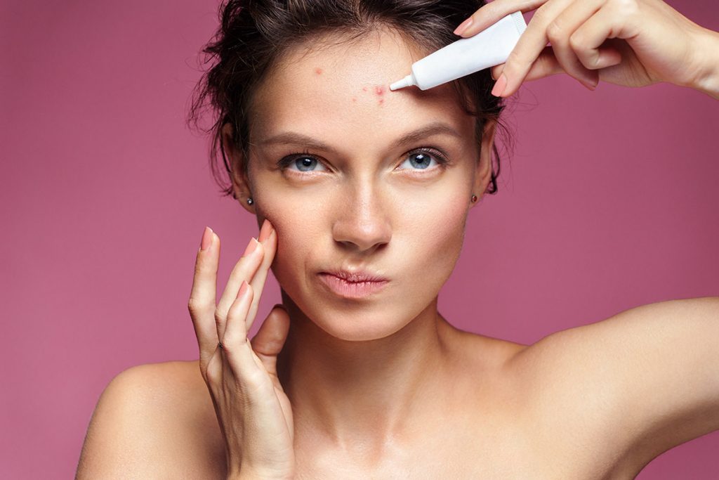 Acne: le diverse forme e come curarla anche a tavola - Melarossa