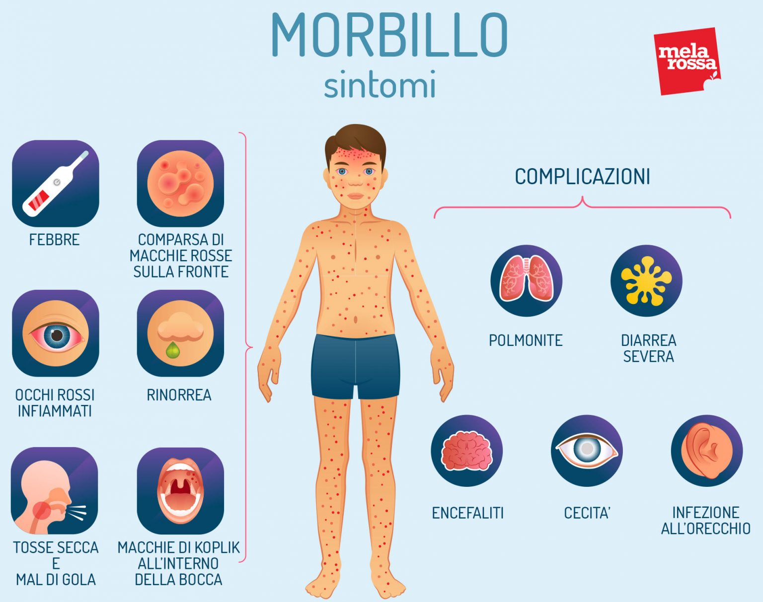 Morbillo: cos'è, cause, sintomi, diagnosi, decorso, cure e prevenzione