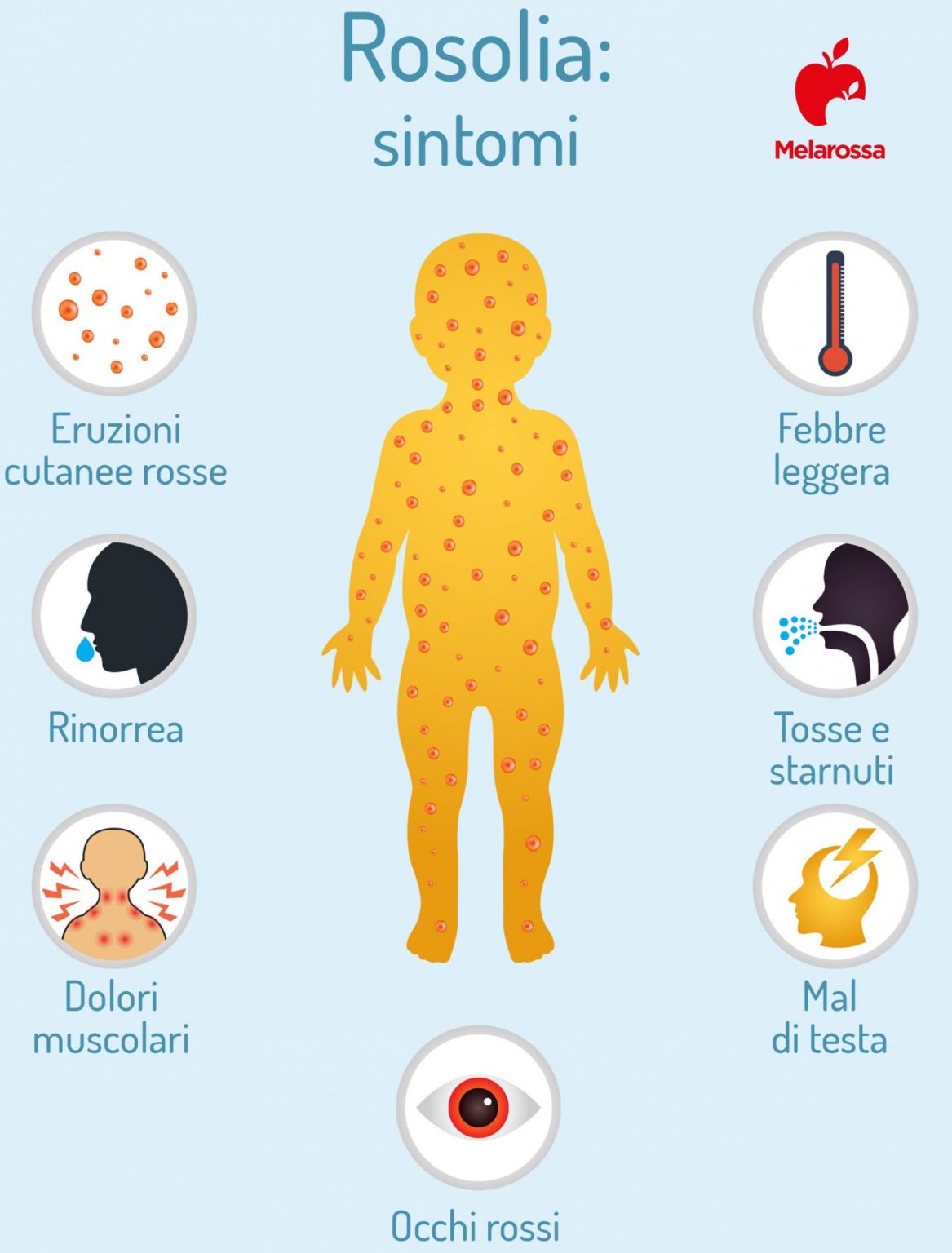 Malattie esantematiche: cosa sono, quali sono e come differenziarle