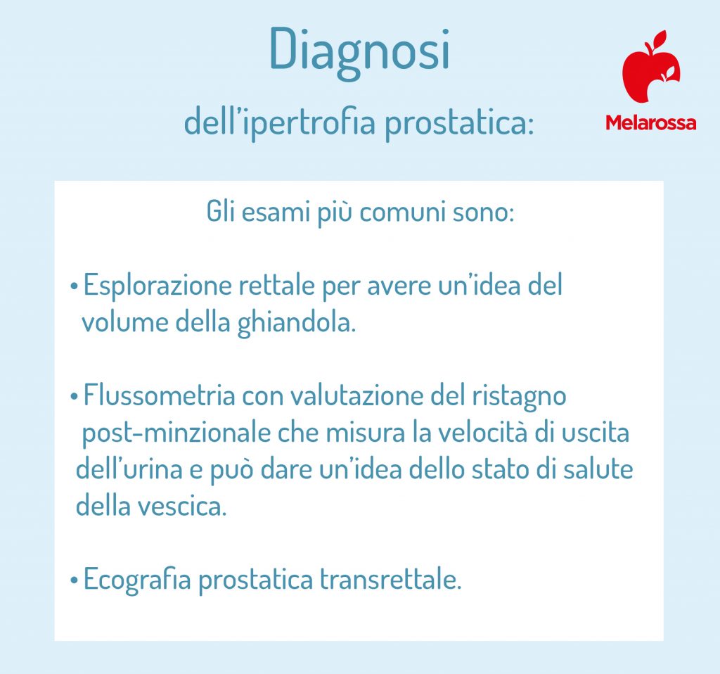 Ipertrofia prostatica benigna: che cos’è, cause, cura ed epidemiologia