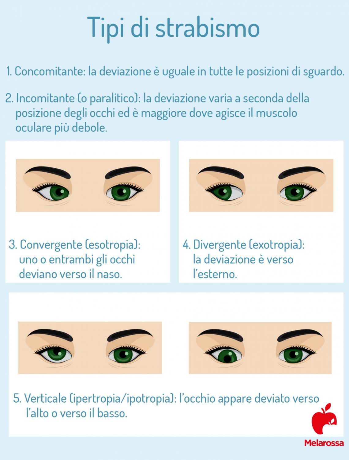 Strabismo: cos’è, tipologie, cause, sintomi, diagnosi e trattamento