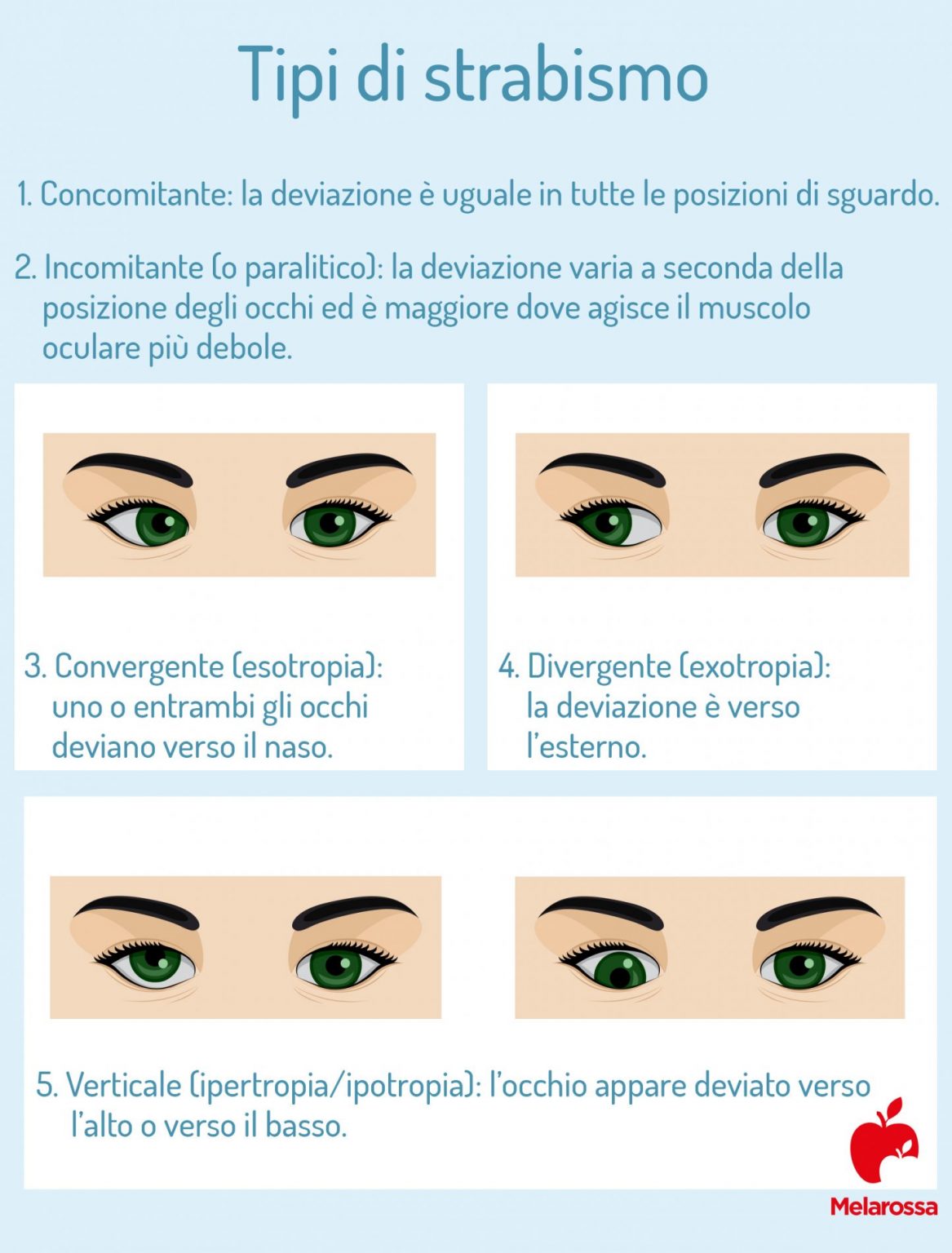 Strabismo: cos’è, tipologie, cause, sintomi, diagnosi e trattamento