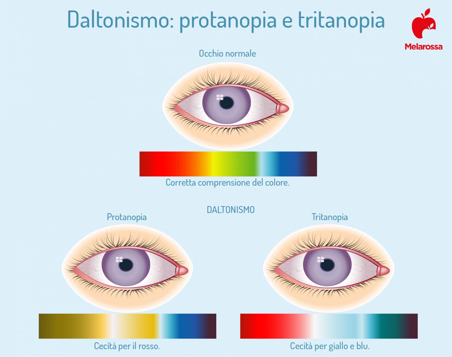 Daltonismo: cos’è, le diverse forme, cause, diagnosi e trattamento