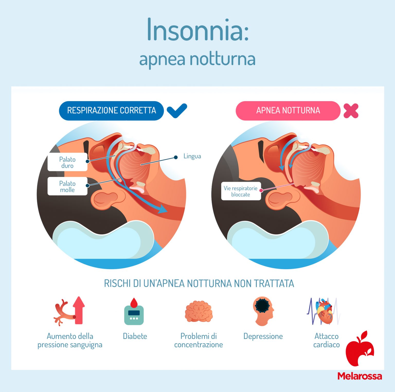 Insonnia: tipologie, cause, conseguenza sulla salute e trattamenti