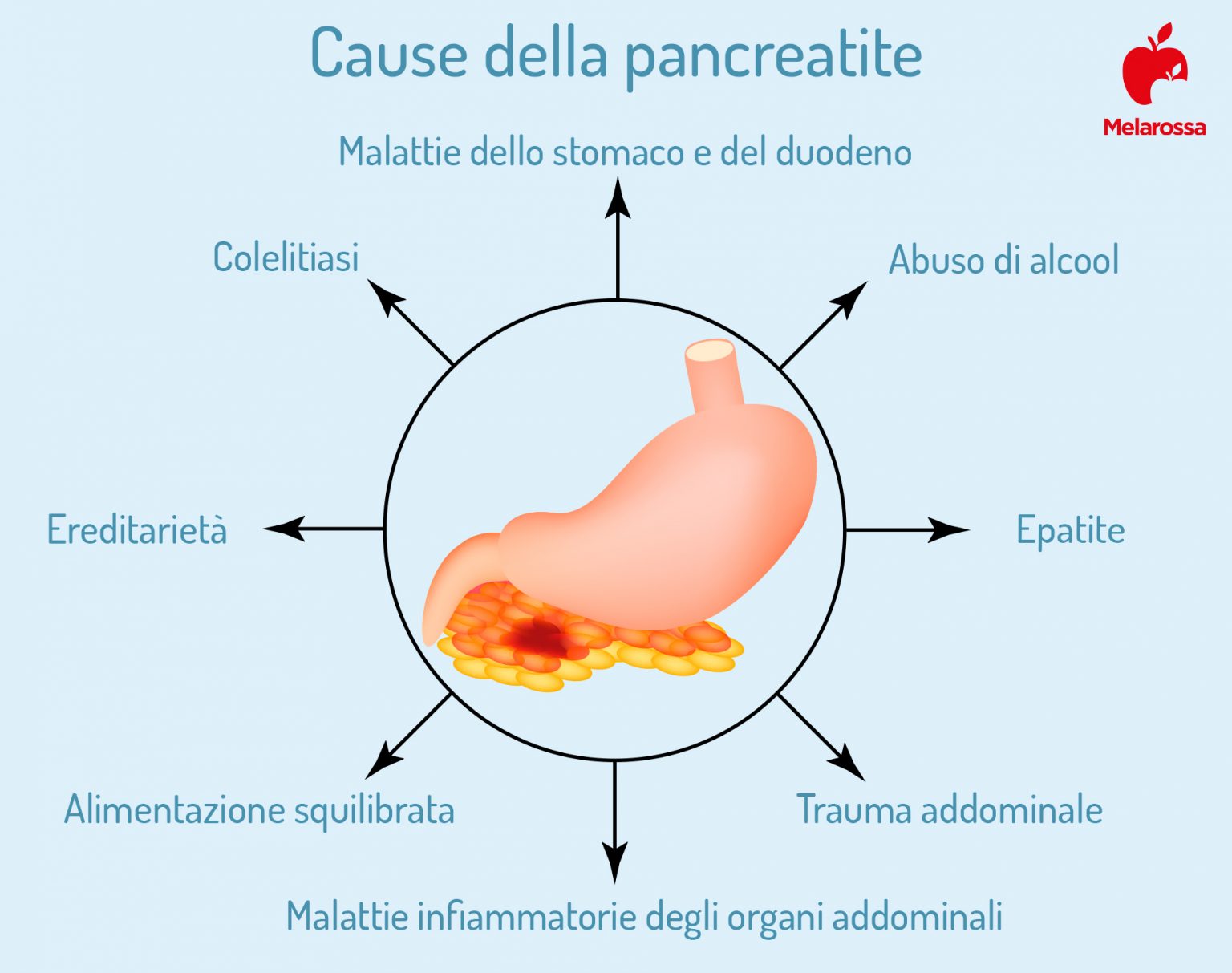 Pancreatite: come riconoscere l'infiammazione del pancreas