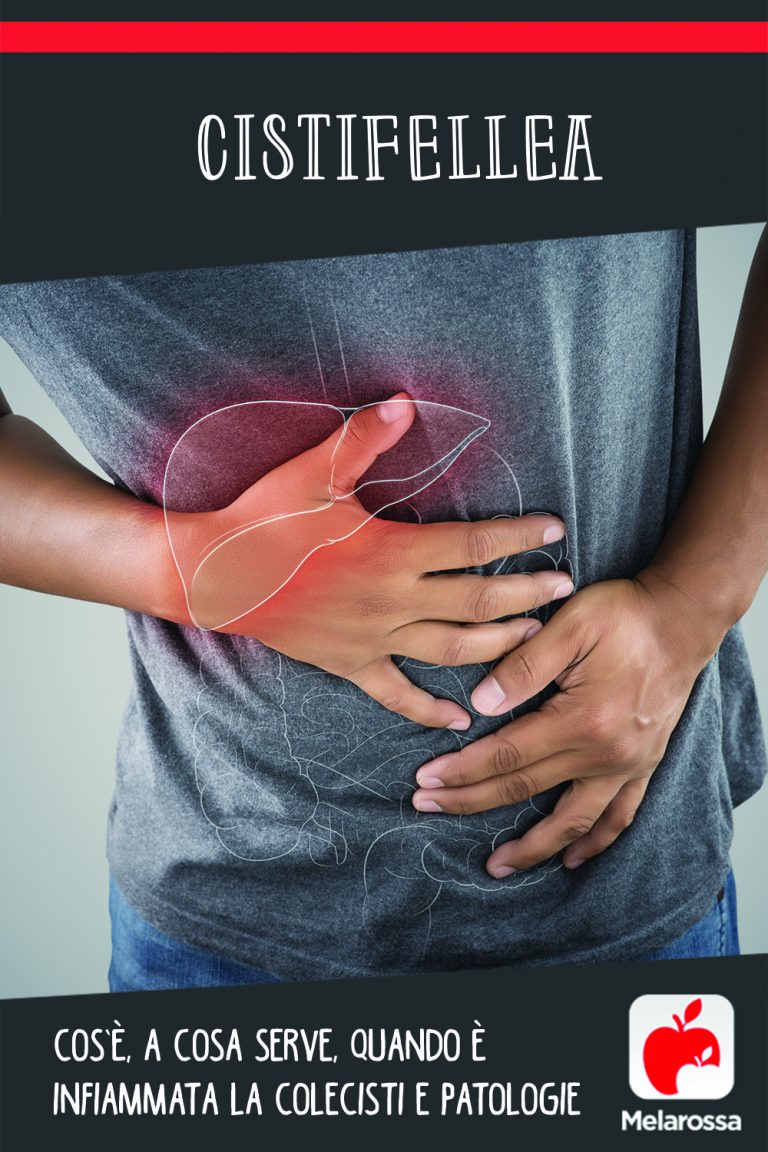 Cistifellea: cos’è, a cosa serve, sintomi quando è infiammata, patologie