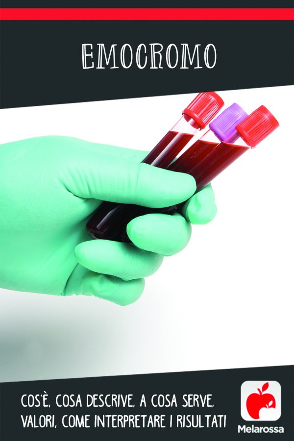 Emocromo: cos’è, cosa descrive, valori, come interpretare i risultati