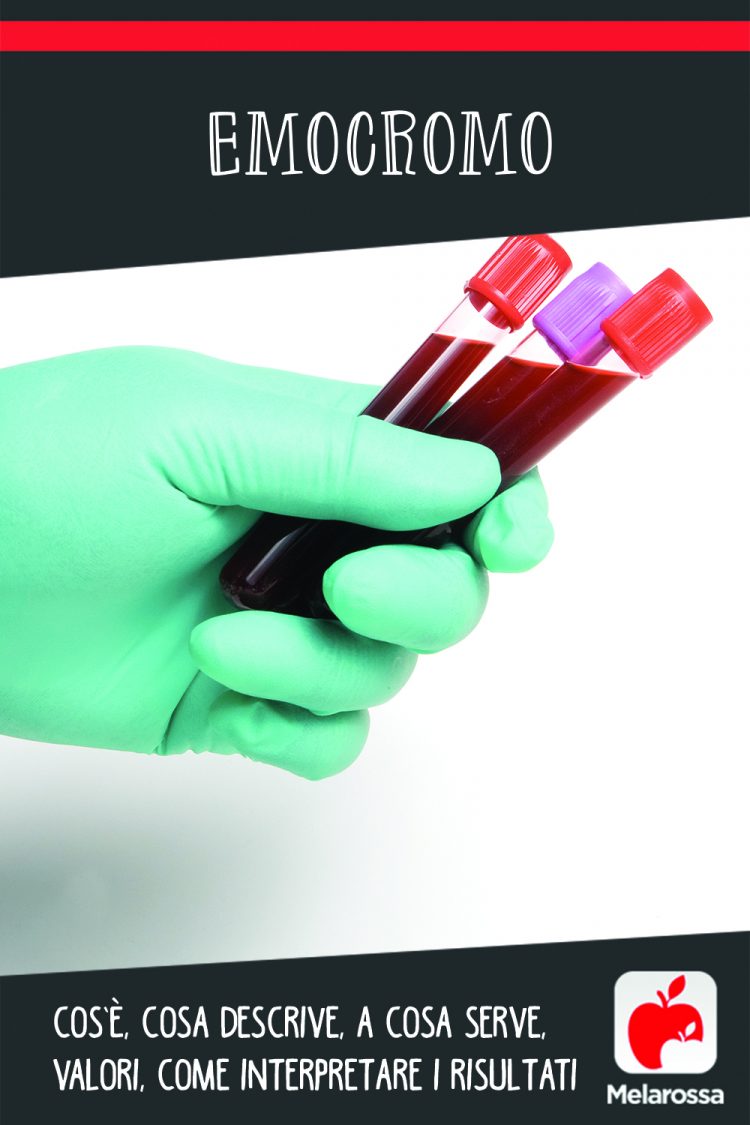 Emocromo: cos’è, cosa descrive, valori, come interpretare i risultati