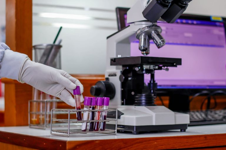 Emocromo: cos’è, cosa descrive, valori, come interpretare i risultati