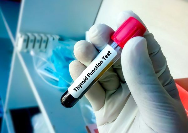 TSH: cos’è, valori normali, alti o bassi e come funziona l'esame ...