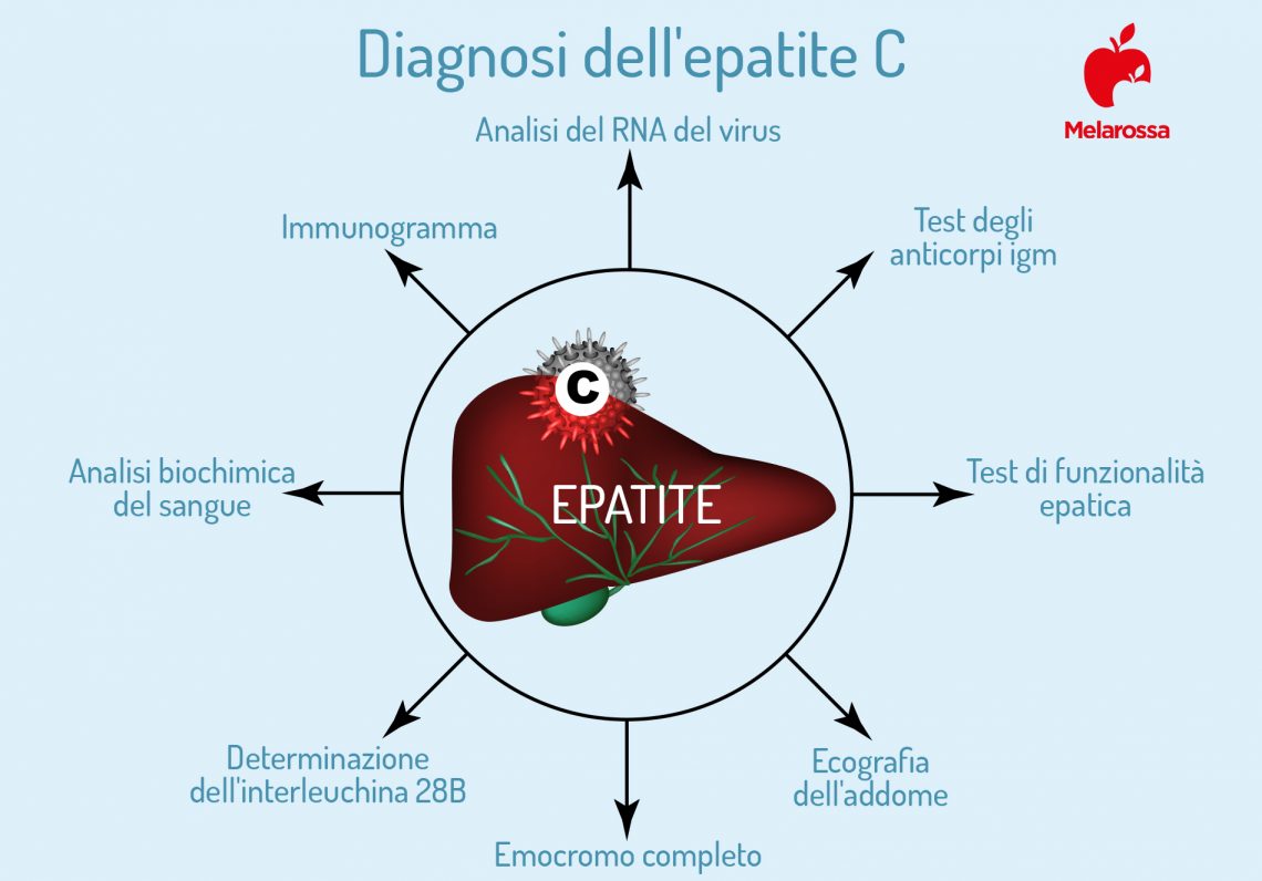 Epatite C: cos’è, cause e sintomi, contagio, diagnosi, cure e prevenzione