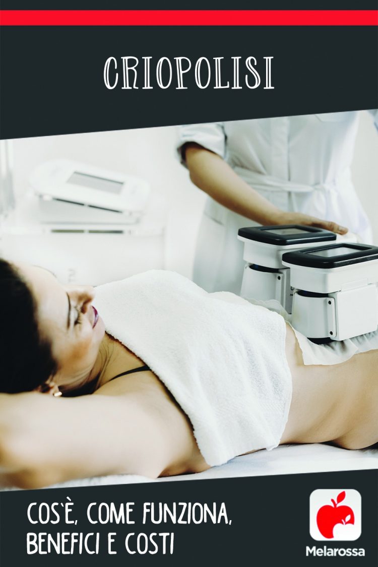 Criolipolisi: cos'è, come funziona, benefici e costi - Melarossa