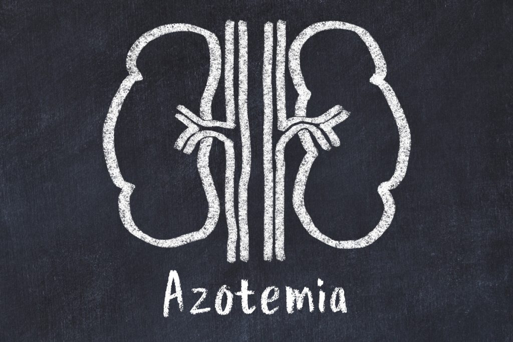 Azotemia: cos’è, valori alti e bassi, quando preoccuparsi, cure e diete
