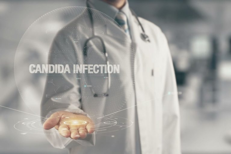Candida: cos'è, tipologie, cause, sintomi, cure e prevenzione