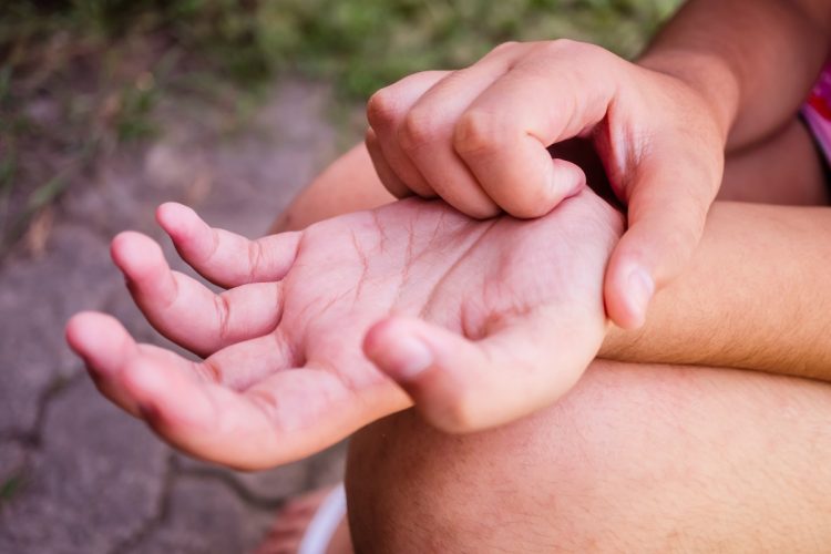 Disidrosi a mani e piedi: cos’è, cause, sintomi, terapia e rimedi