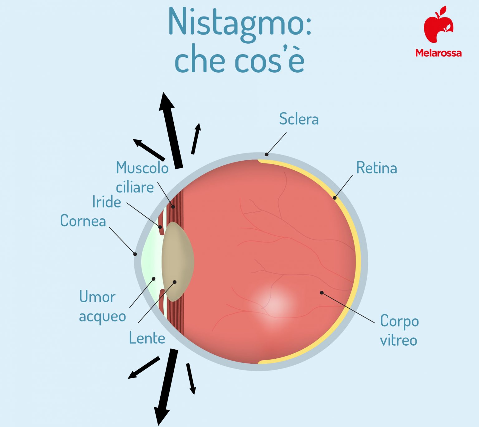 Nistagmo: cos’è, tipi, cause, come si manifesta, diagnosi, cure