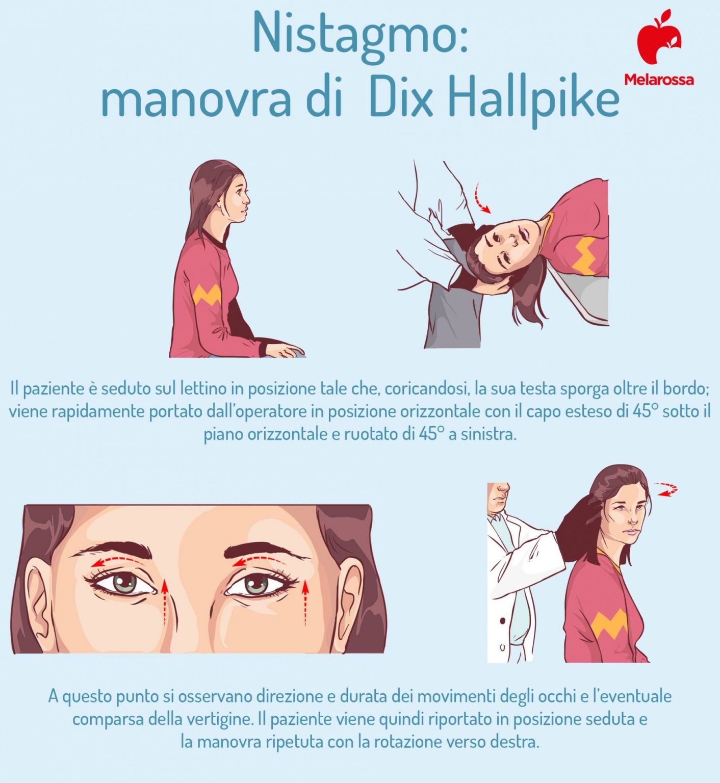 Nistagmo: cos’è, tipi, cause, come si manifesta, diagnosi, cure