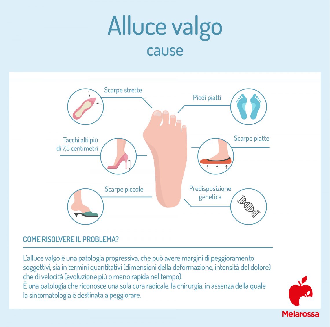 Alluce valgo: cause, sintomi, prevenzione e rimedi - Melarossa