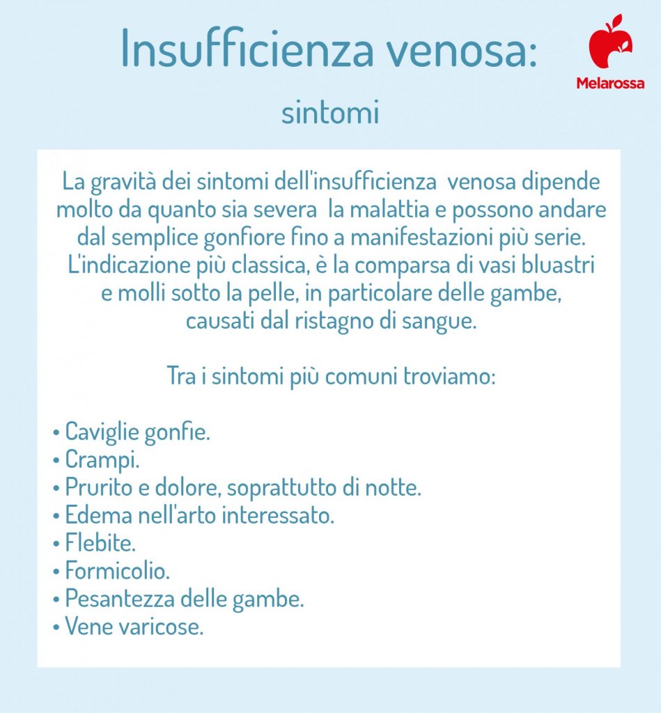 Insufficienza venosa: sintomi, cause, terapia e rimedi - Melarossa
