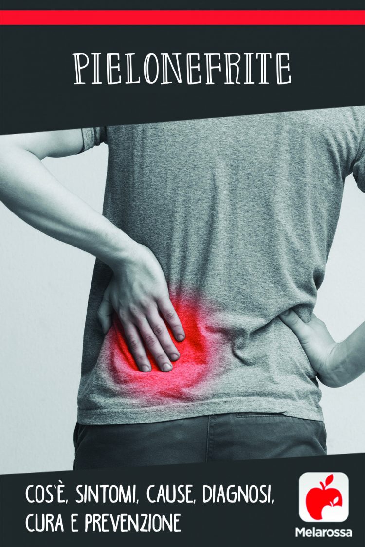 Pielonefrite: cos’è, sintomi, cause, diagnosi e cura - Melarossa