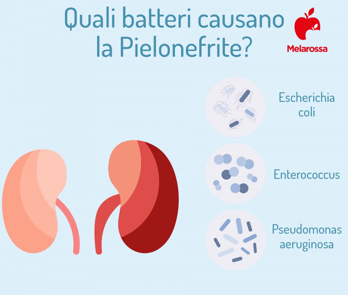Pielonefrite: cos’è, sintomi, cause, diagnosi e cura - Melarossa