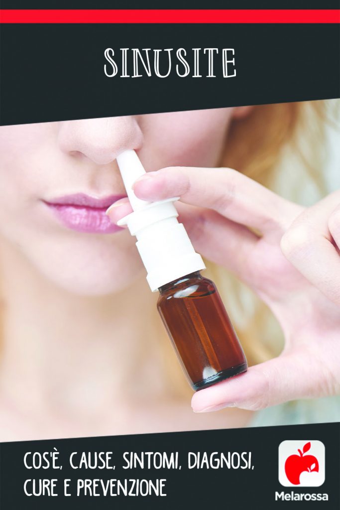 Sinusite: cos'è, cause, sintomi, diagnosi, cure e prevenzione