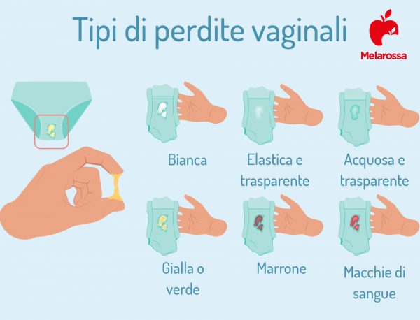 Vaginite: cos’è, tipi, cause, sintomi e trattamenti - Melarossa