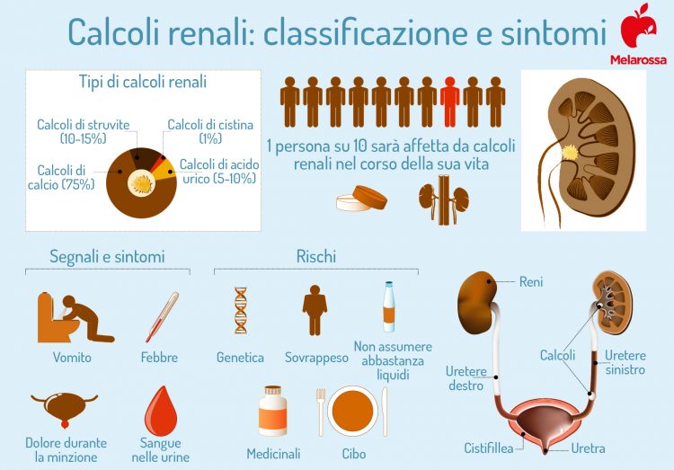 Calcoli renali: cosa sono, sintomi, cause, cura e prevenzione