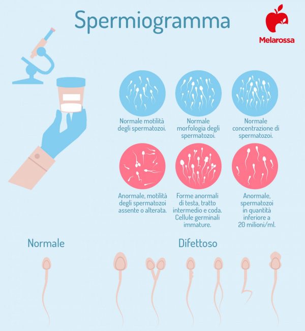 Spermiogramma: cos’è, come funziona, risultati, diagnosi e costi