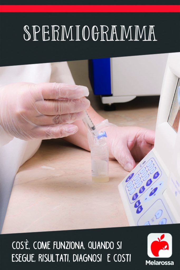 Spermiogramma: cos’è, come funziona, risultati, diagnosi e costi