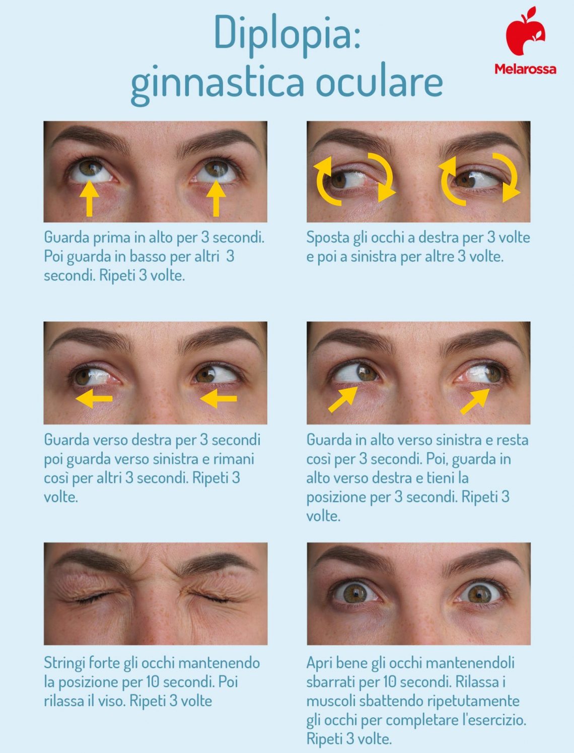 Diplopia: che cos’è, cause, tipi, sintomi, diagnosi e cure