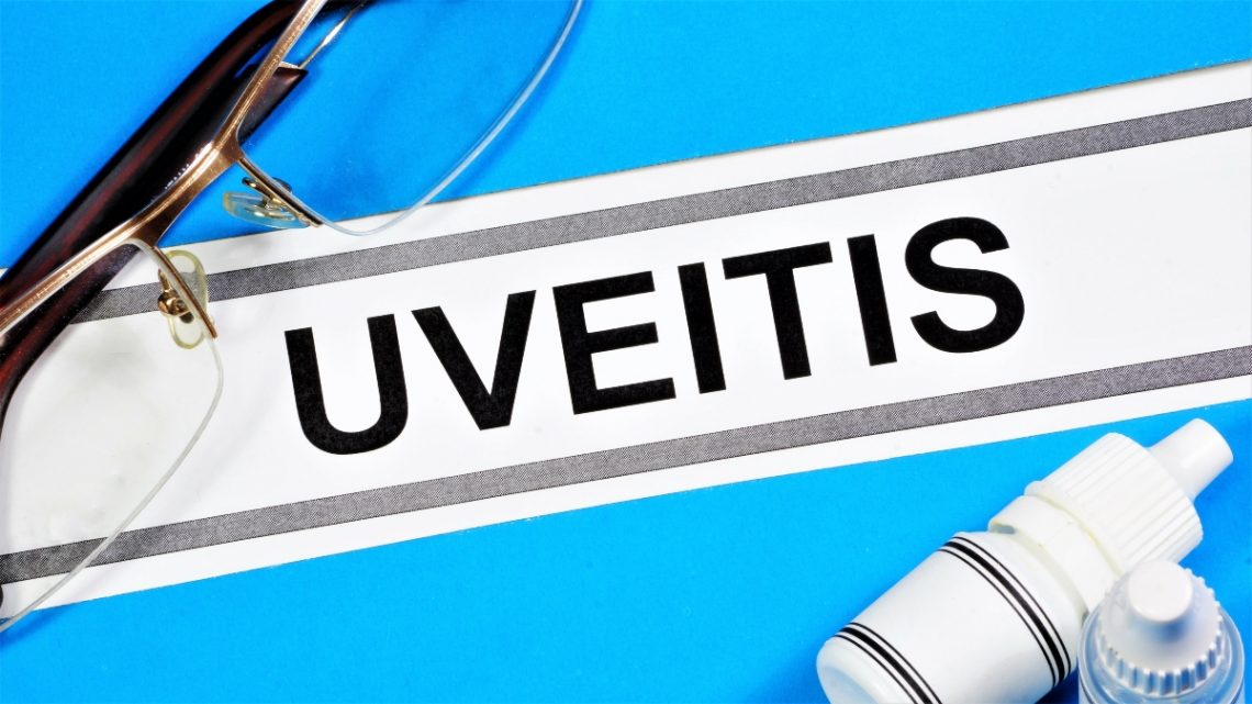 Uveite all’occhio: cos’è, quanti tipi esistono, cause, sintomi ...