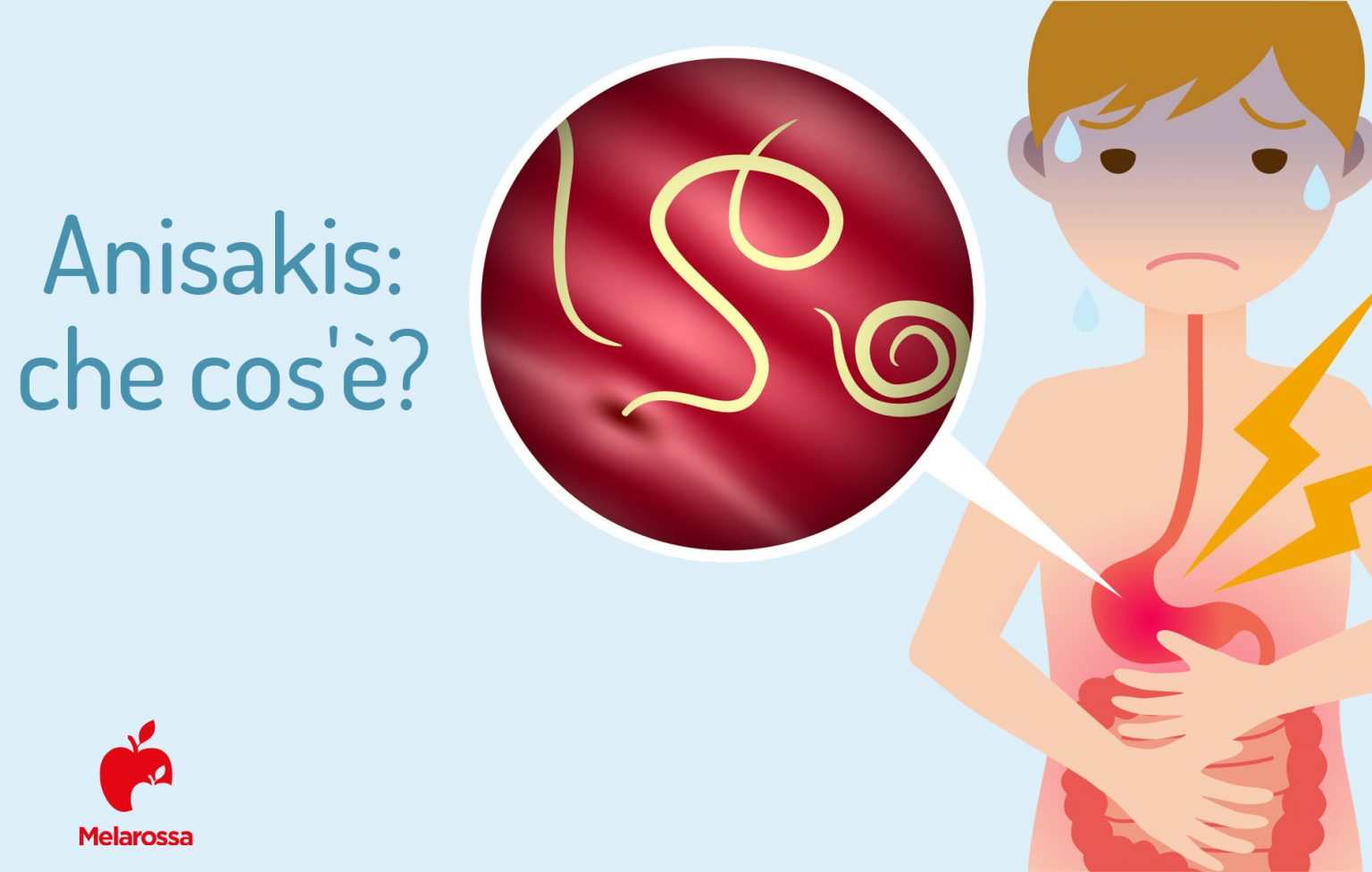 Anisakis: cos’è, sintomi, cause, diagnosi, cure, prevenzione