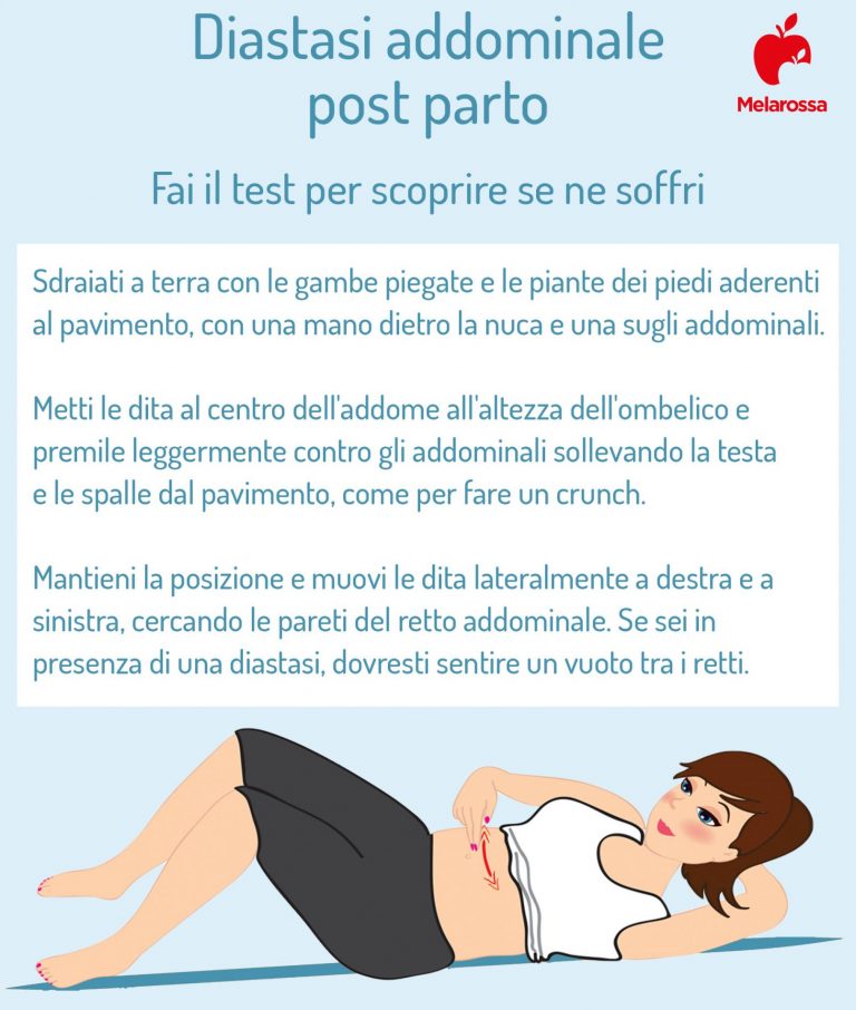 Diastasi addominale: cos'è, sintomi, cause ed esercizi - Melarossa