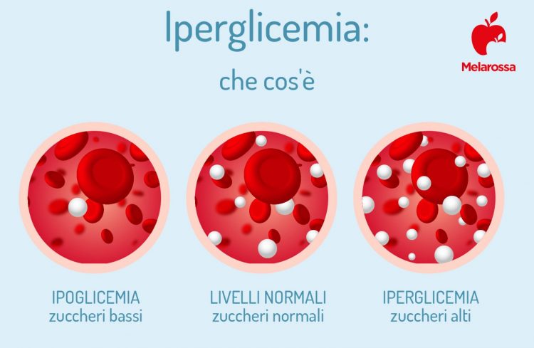 Glicemia alta e bassa: sintomi, valori e come si misurano