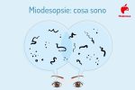 Miodesopsie: cosa sono, cause e patologie correlate, sintomi, cure