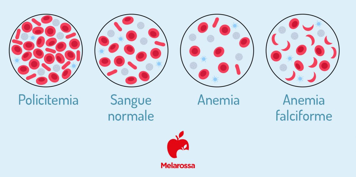 Eritrociti, globuli rossi: cosa sono, valori, cosa fare quando sono ...