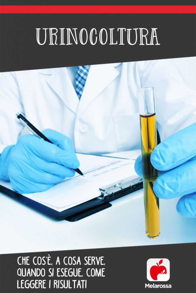 Urinocoltura: che cos’è, a cosa serve, quando si esegue, risultati