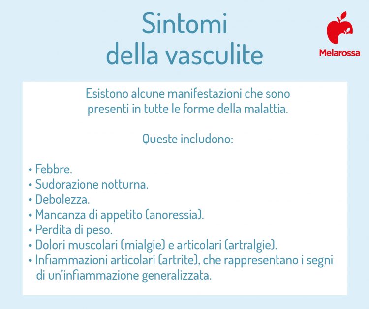 Vasculite: cos’è, sintomi, classificazione, cause, diagnosi, cure