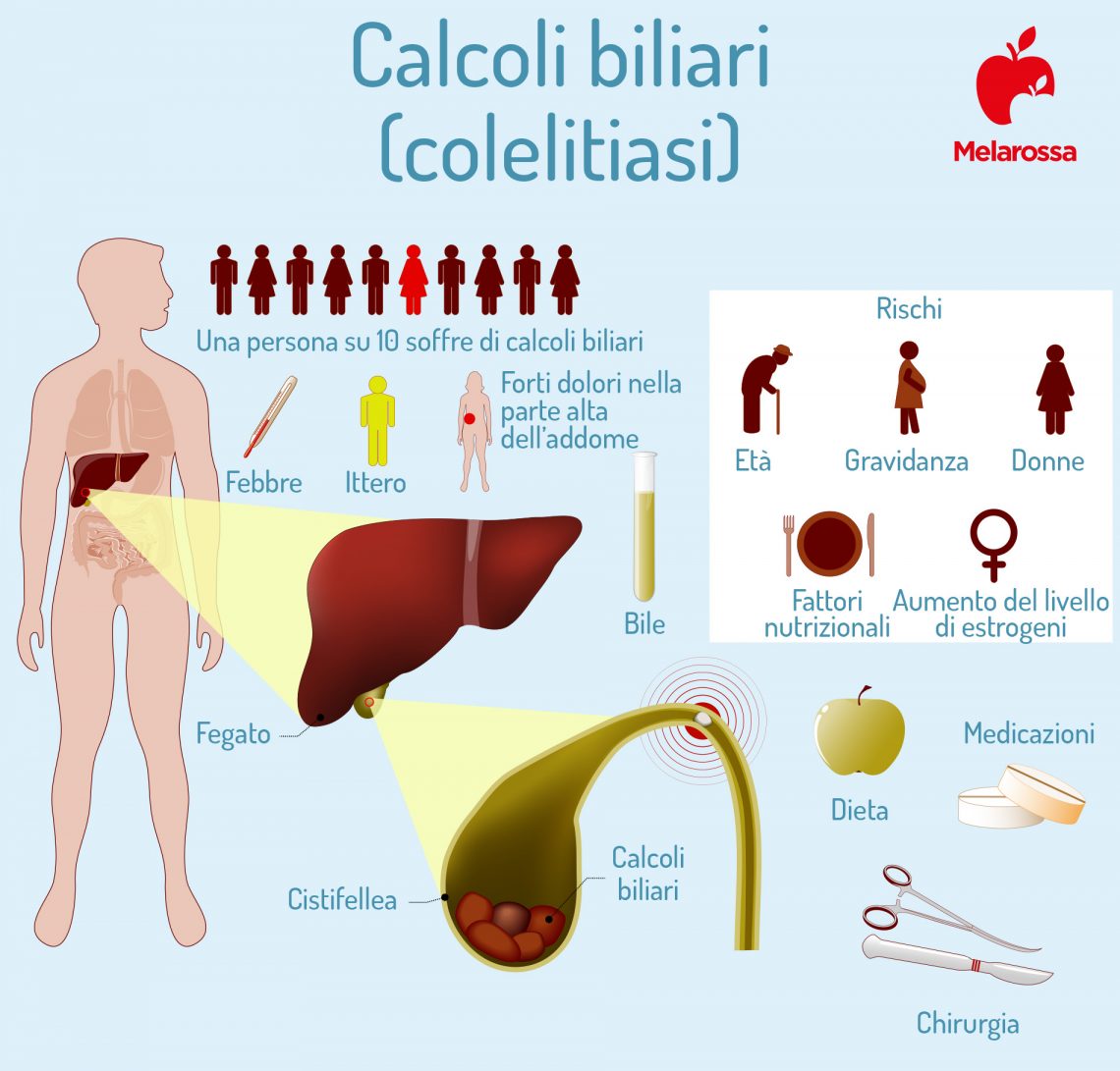 Calcoli biliari: cosa sono, sintomi, cause, diagnosi e cura