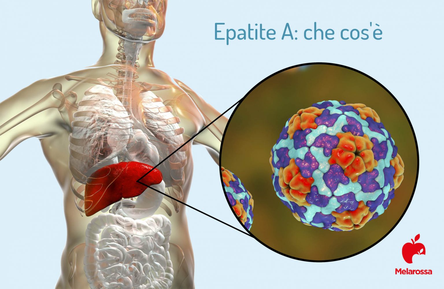 Epatite A: che cos’è, sintomi, cause, cura e come si trasmette