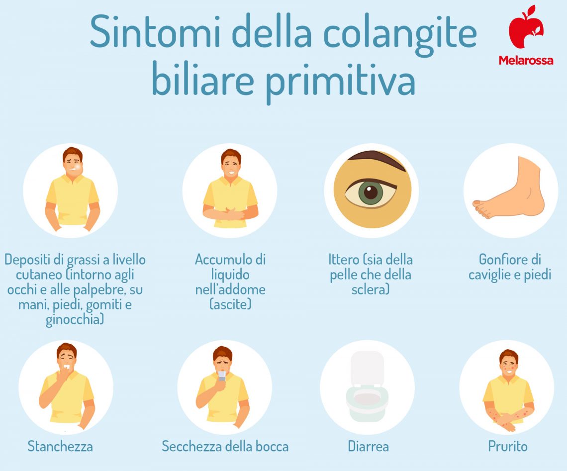 Colangite: cos’è, sintomi, cause e trattamento